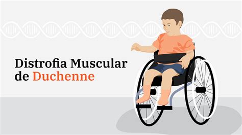 Cromossomo Da Distrofia Muscular De Duchenne Distrofia Muscular De