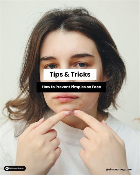 Easy Ways To Prevent Pimples On Your Face Prevent Pimples Pimples On Face Pimples