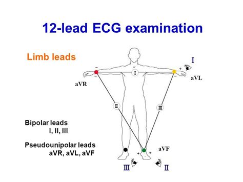 What Does Avf Stand For In Ecg At Henry Street Blog