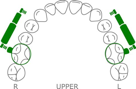 Class Correctors Orthodontic Resource Group