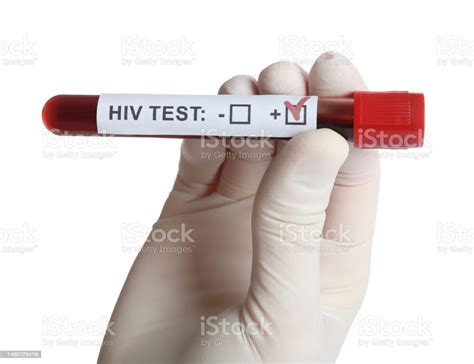 혈액 샘플이 있는 튜브를 들고 흰색 배경에 Hiv 테스트에 라벨을 붙이는 과학자 근접 촬영 Stem 주제에 대한 스톡 사진 및 기타 이미지 Istock