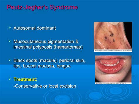 Oral Manifestations Of Systemic Diseases Ppt