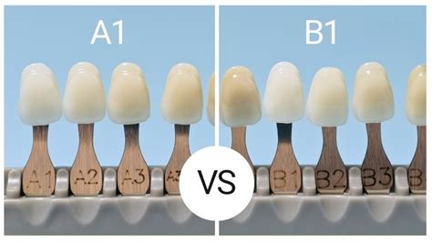 A1 Tooth Shade Is It Really White Or Just Natural
