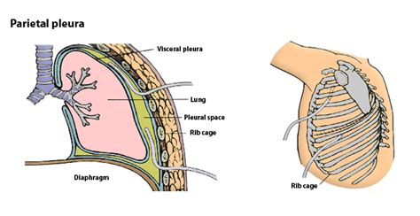 Chest Tube Drainage System Ticare® Chest Drainage System 2 Chambers