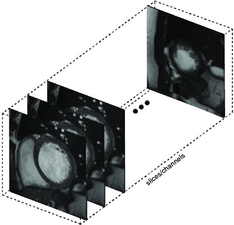 3 One Of Preprocessed 3d Cardiac Data From Acdc Dataset The Cardiac Download Scientific