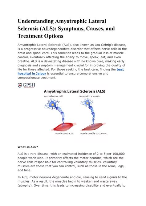 Ppt Understanding Amyotrophic Lateral Sclerosis Als Symptoms Causes And Treatment Options