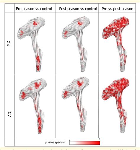 Figure 5 From Integration Of Diffusion Tensor Imaging Parameters With Mesh Morphing For In Depth