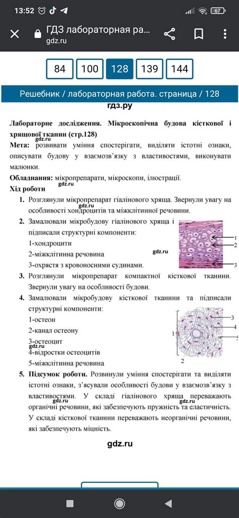 ДАЮ 40 БАЛЛОВ ЗА ЧЕТКИЙ ОТВЕТ Лабораторне дослідження МІКРОСКОПІЧНА БУДОВА КІСТКОВОЇ І
