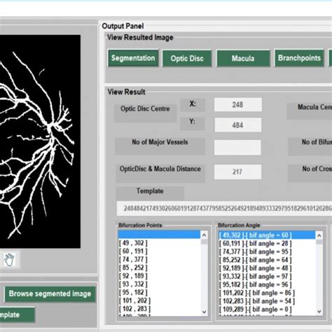 Segmentation From Original Fundus Images Download Scientific Diagram