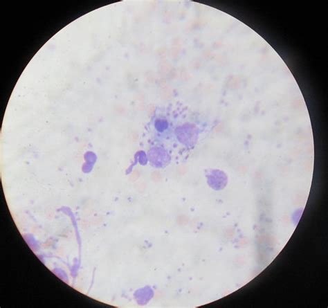 利什曼原虫 巨噬细胞 体前鞭毛 原生动物 单细胞生物 溃疡 寄生的 瘟疫 形态学 蚊子摄影素材 汇图网www huitu