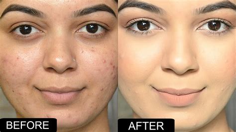 Makeup For Oily Skin With Large Pores Saubhaya Makeup