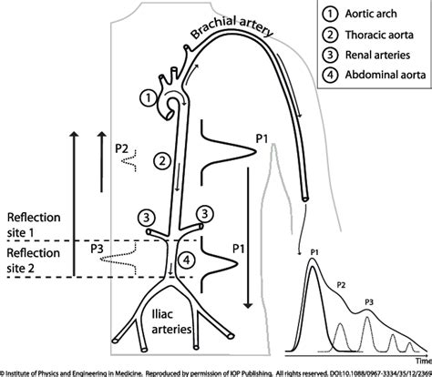Ppg Sketch At Explore Collection Of Ppg Sketch