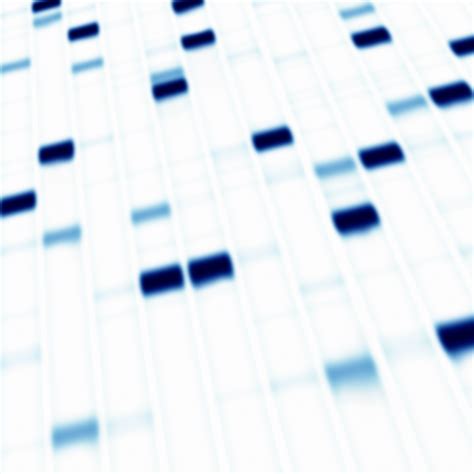 Genetic Variations Predispose Copd Patients To A More Severe Form Of