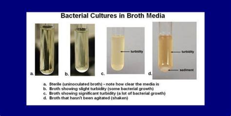 Quantification Of Microbes Flashcards Quizlet