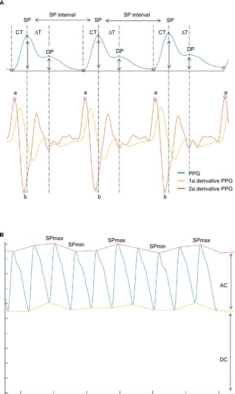 Identification Of Ppg Parameters Abbreviations Sp Systolic Peak Dp Download Scientific
