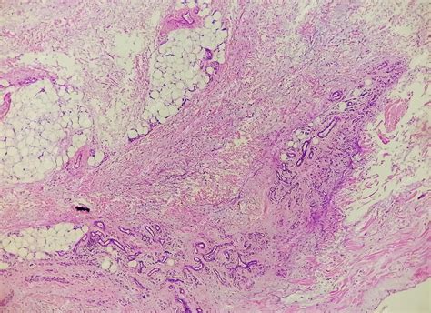 Premium Photo Photomicrograph Prepatellar Region Histology Showing
