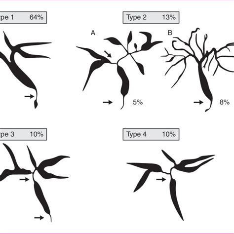 Classification Of Igg4 Related Cholangitis 83 Related To Statement 3 2 Download Scientific