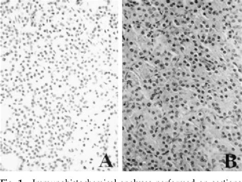 Figure 1 From Tc Tetrofosmin Uptake In Parathyroid Adenomas Semantic Scholar