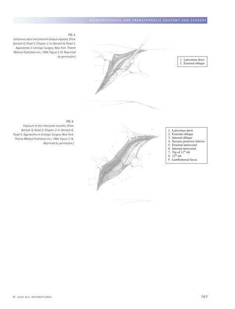 Solution Retroperitoneal And Transthoracic Anatomy And Surgical