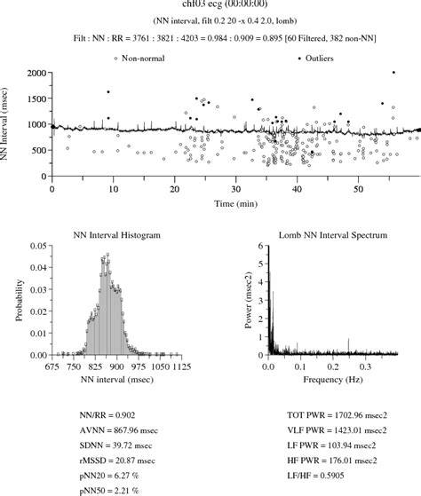 Heart Rate Variability Analysis With The Hrv Toolkit