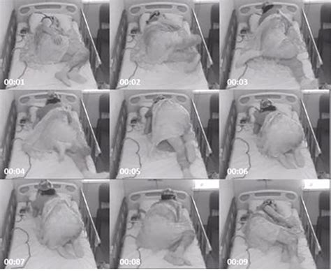 One Of Focal Stereotyped Motor Seizures Captured During Overnight Download Scientific
