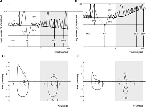 Pathogenesis Of Hyperinflation In Chronic Obstructive Pulmonary Disease