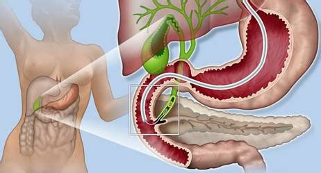 ERCP Specialist Dr Venkatesh Pabbisetti