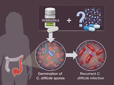 Clostridium Difficile Toxin