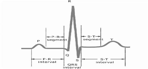 Shape Of A Healthy Ecg Heartbeat Signal Download Scientific Diagram