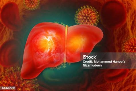 지방간 섬유증 간경변 및 간암과 같은 간 손상 3d 일러스트레이션 간 내부 기관에 대한 스톡 사진 및 기타 이미지 간 내부
