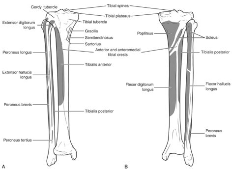 Proximal Third Tibia Fracture Trauma Orthobullets