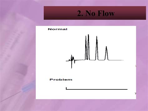 Hplc Trouble Shooting Final Ppt