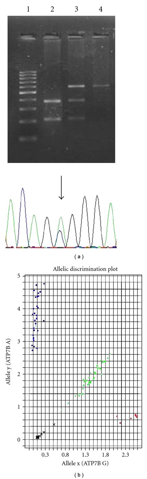 Analytical Procedures For Atp7b Snps Detection A Pcr Restriction