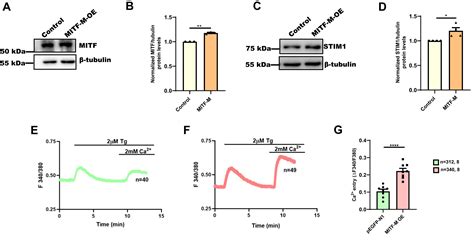 Mitf Is A Novel Transcriptional Regulator Of The Calcium Sensor Stim1