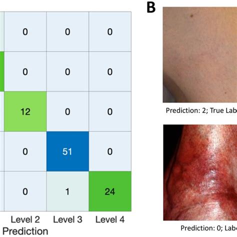 Overview Of The Proposed Venet For Cvd Severity Classification And