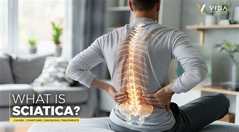 What Is Sciatica Causes Symptoms Diagnosis Treatments
