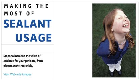 Making The Most Of Sealant Usage Dimensions Of Dental Hygiene