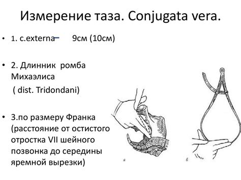 Акушерские исследования наружные внутреннее Диагностика беременности презентация онлайн