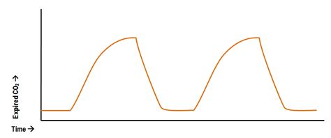 Abnormal Capnography Waveforms And Their Interpretation Deranged