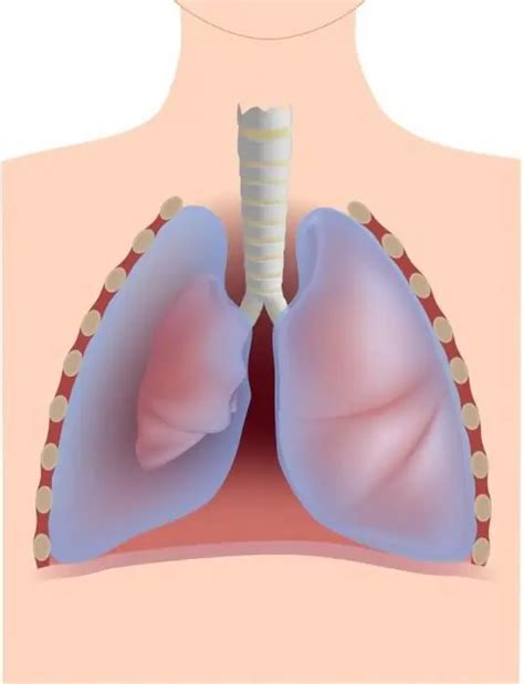 Description Of Pneumothorax Types Of Disease Causes Diagnosis And