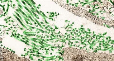 Cell First Image Of Ebola Virus Structure Its Relatives Obtained News Am Medicine All