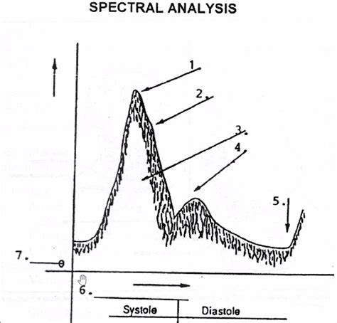 SPECTRAL ANALYSIS Diagram Quizlet