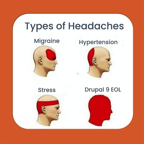 Drupal Drupal10 Migration Valuebound