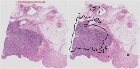 Analyze Health And Biology Related Tabular Textual And Image Data By