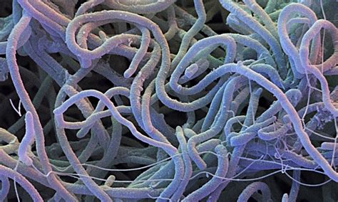 Does The Ocean Hold The Key To Killing Anthrax Discovery Of Deep Sea