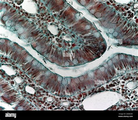 Small Intestine Tissue Light Micrograph Section Through Folds Of
