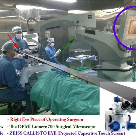 Orientation Of The Surgical Microscope And Integrated Intraoperative Download Scientific