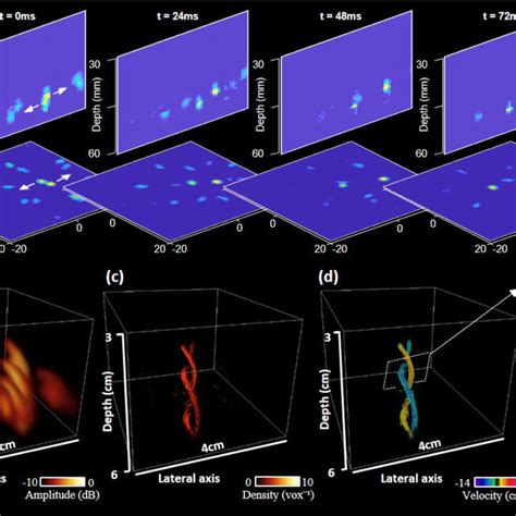 Ultrasound Localization Microscopy Ulm Of A Tube Using The 4λ Matrix