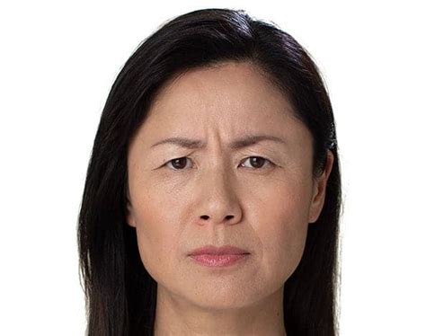 Daxxify Vs Botox Everything There Is To Know