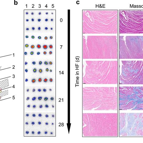 ⁶⁸ga Labelled Fibroblast Activation Protein Fap Inhibitor ⁶⁸ga Fapi